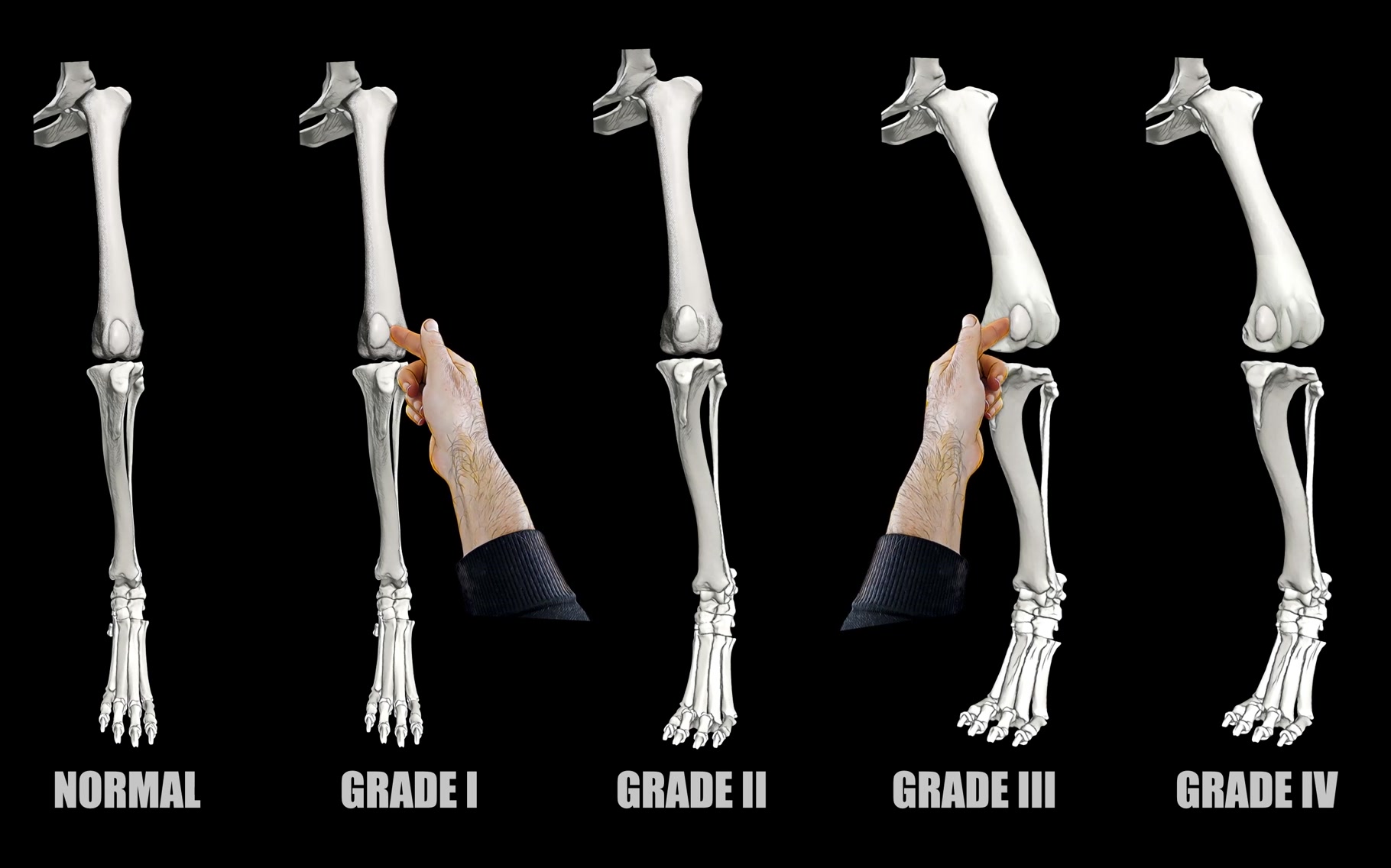 Medial Patellar Luxation Grading Experience The Cause And Consequences Of Patellar Luxation