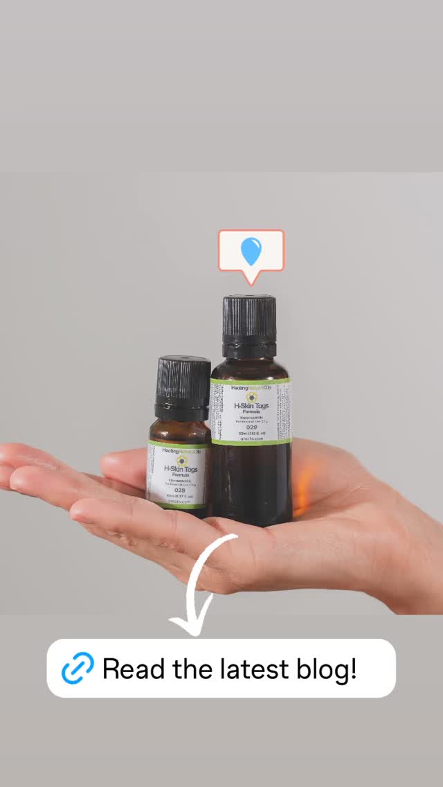 Did You Know That Warts May Spread To Other Parts Of Your Body And Can 8484