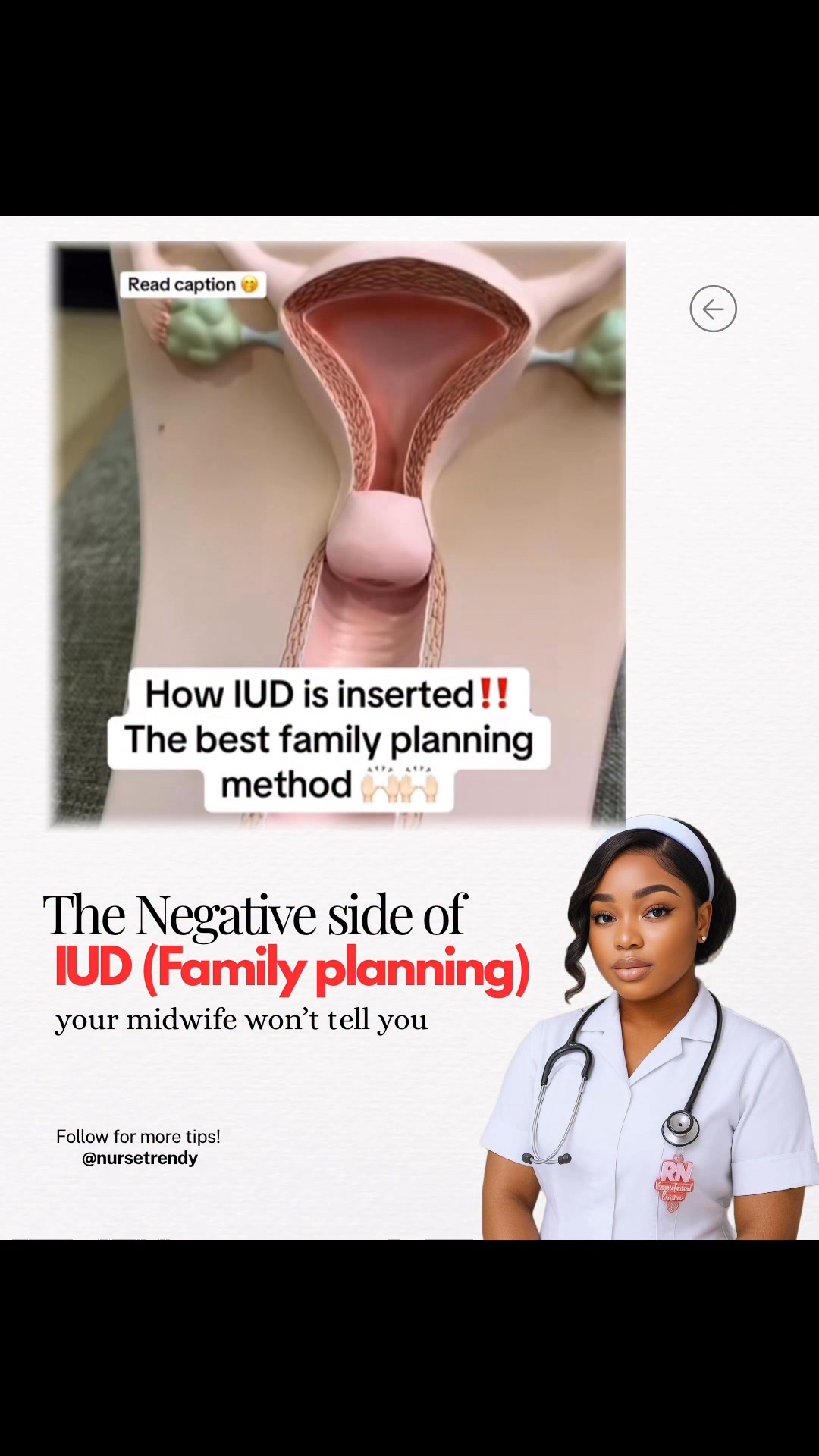 “the Bad Effects Of Iuds They Dont Really Talk About…” Iuds Are Very