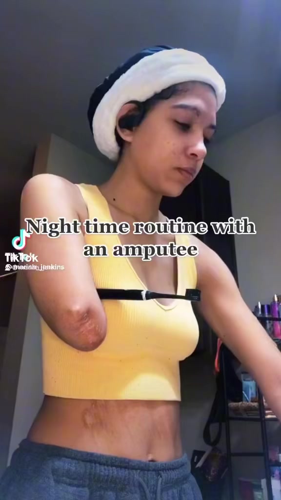 Amputee Cute 🥰 By Amputee Girl Beauty Group