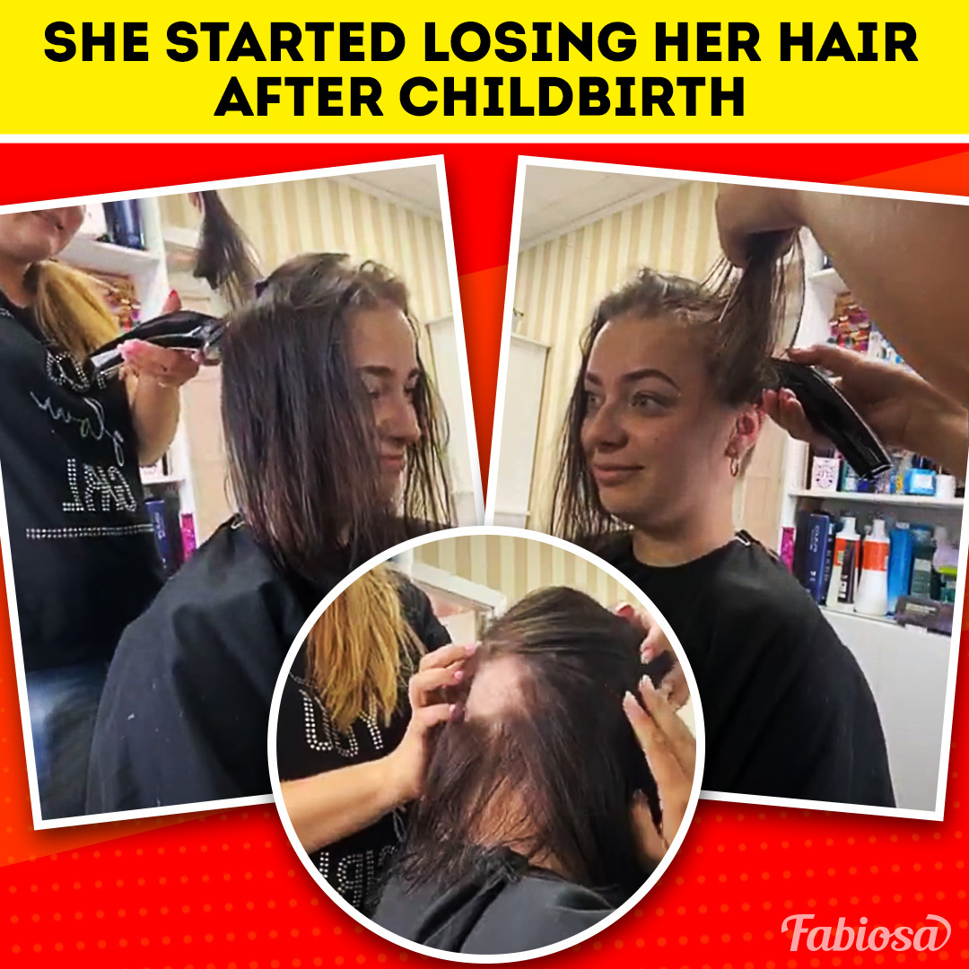 A Young Mom Shaved Her Head Because Of Her Illness And Was Slammed For 2634