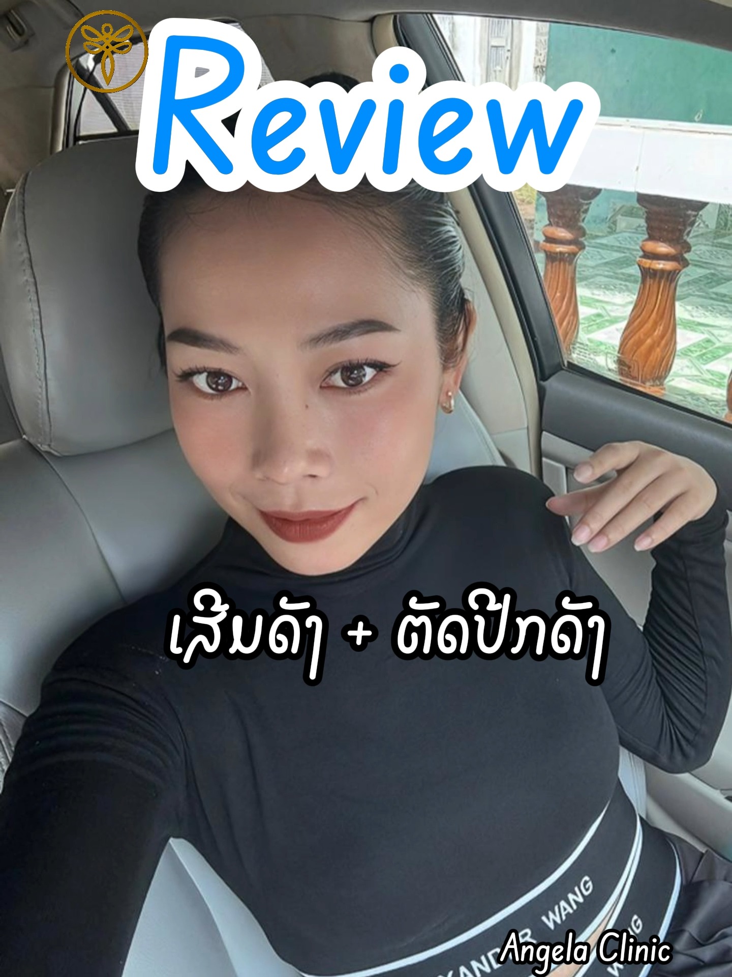 Chess 14 Sexy Amazingly Beautiful💋🦋😍 Sexy Amazingly Beautiful💋🦋😍 Slingshot Slingshotride
