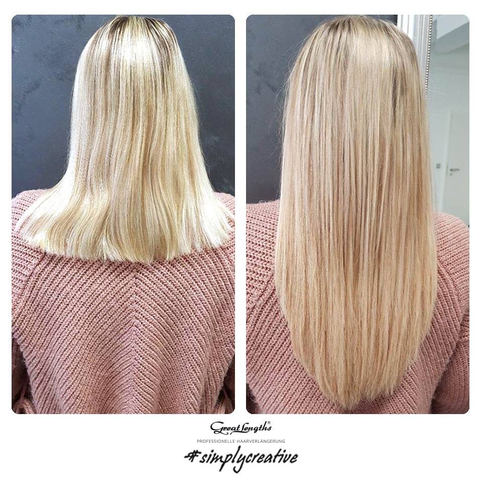 Extensions 50 Cm Vorher Nachher