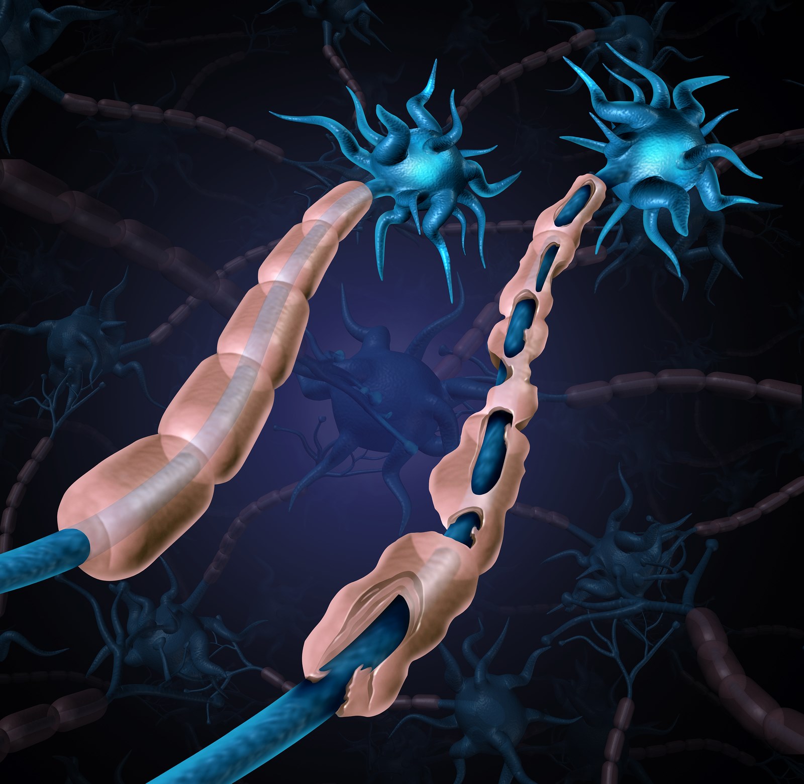 Physiopedia Its World Ms Day Msconnections Worldmsday We Created 0624