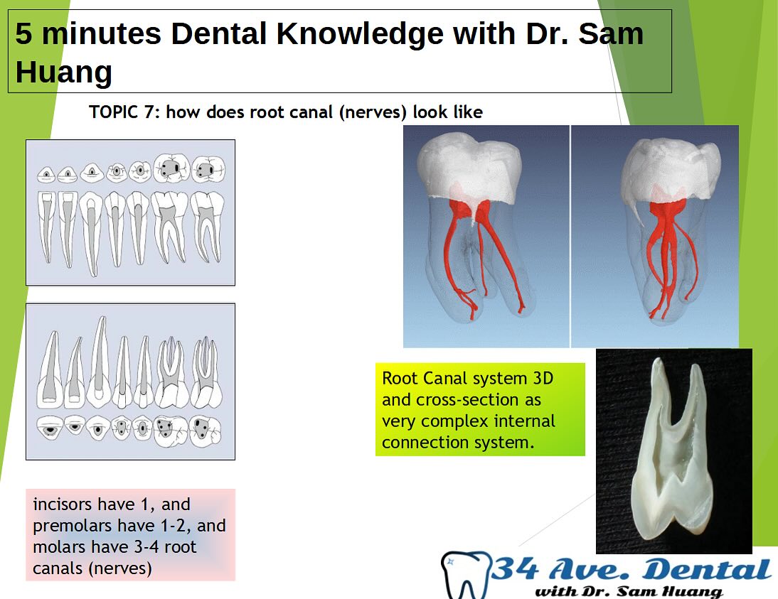 34 What Does The Tooth Nerve Look Like Follow For More Dental Fun 5387