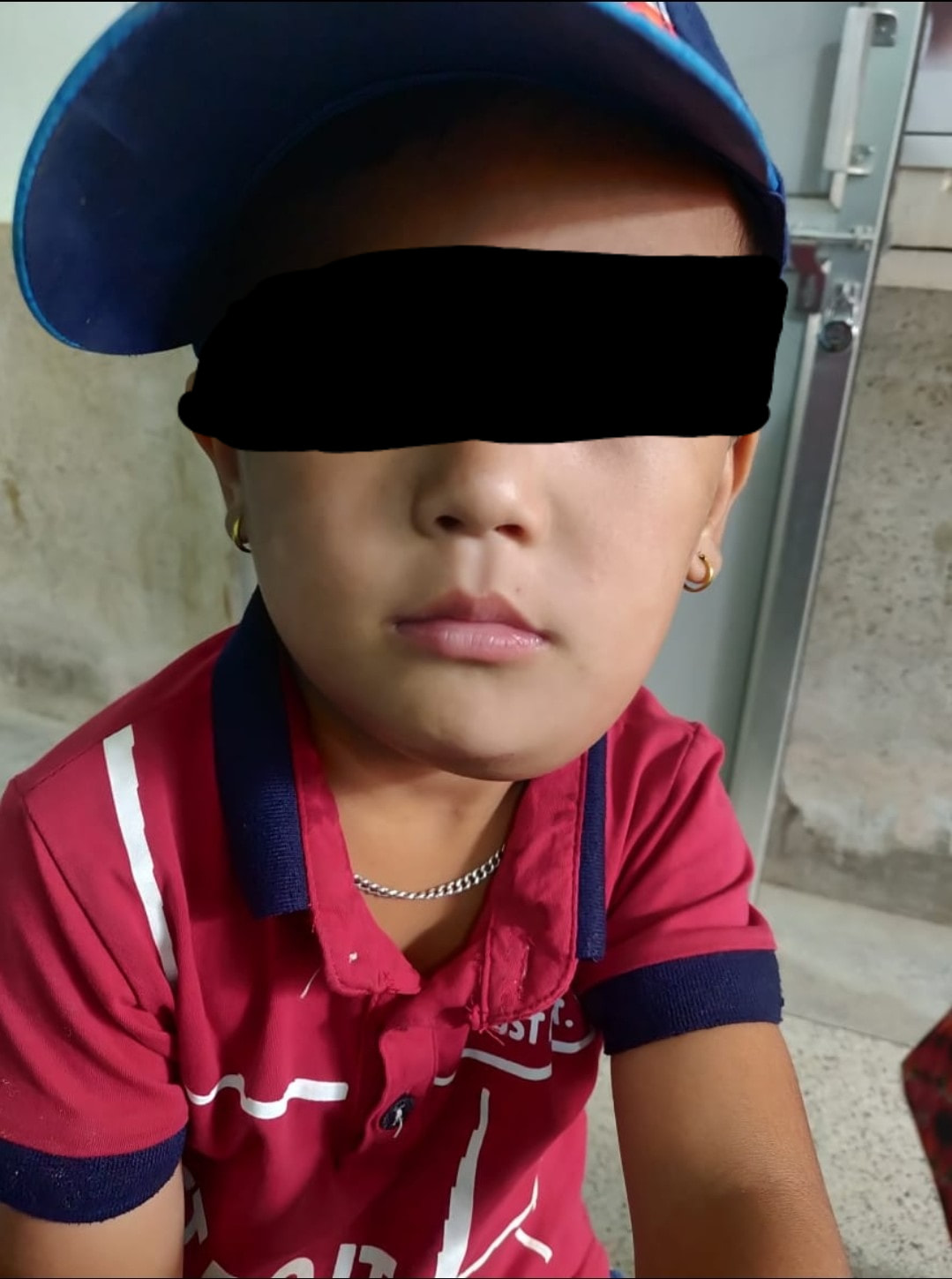 Submandibular Lymph Node Swelling Due Dr Kishor Subedi Facebook 3462