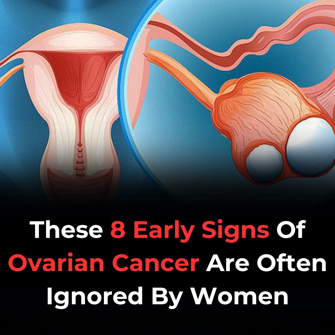Feedy 8 Early Warning Signs Of Ovarian Cancer You Shouldnt Ignore