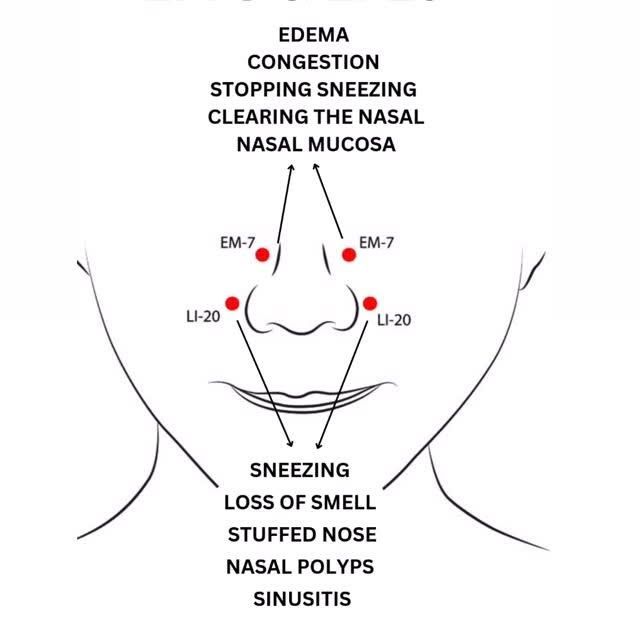 Sapna Acupressure Point For Face Fblifestyletyle