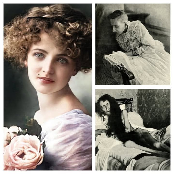 Sidcley A Incrível História De Blanche Monnier Fechada Em Um Quarto