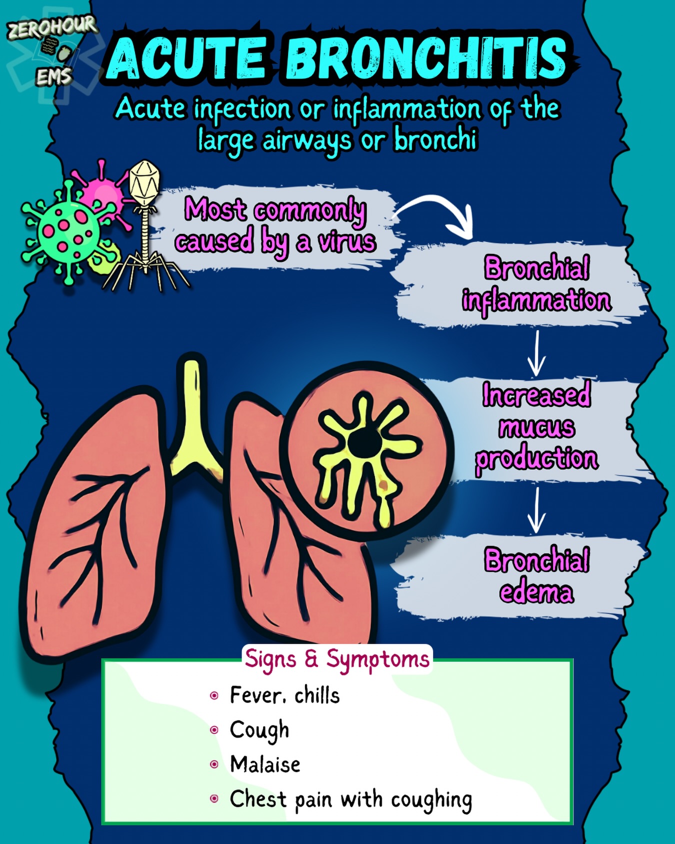 Zerohourems - Acute Bronchitis... CAUSES: 🦠 Viruses 🦠 Bacteria 💨 ...