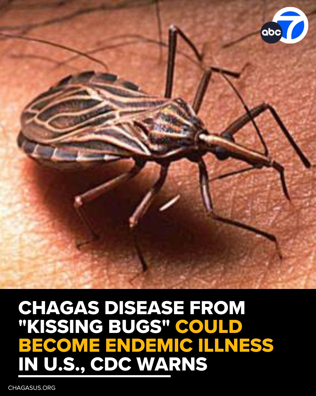 ABC7 - The CDC says a potentially deadly condition could become an ...