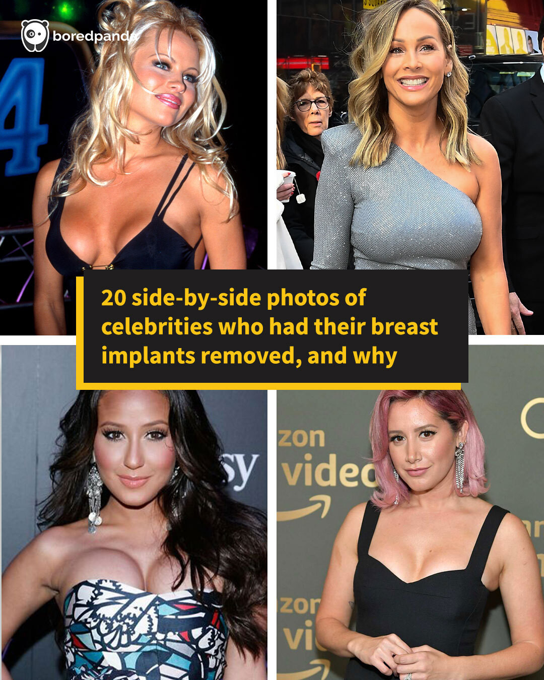 Bored 20 Side By Side Photos Of Celebrities Who Had Their Breast