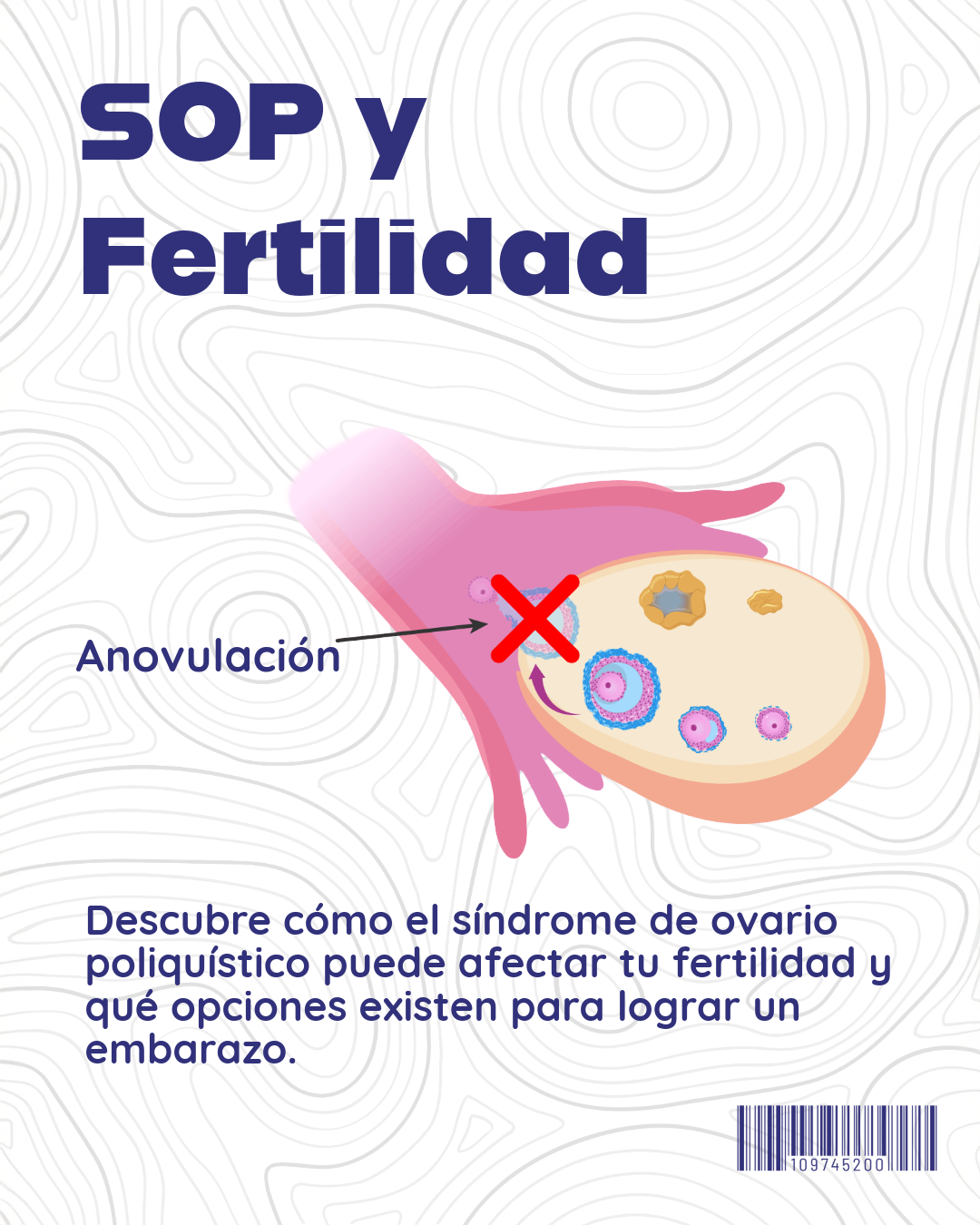 Dr El Síndrome De Ovario Poliquístico Sop Es Una De Las 9578
