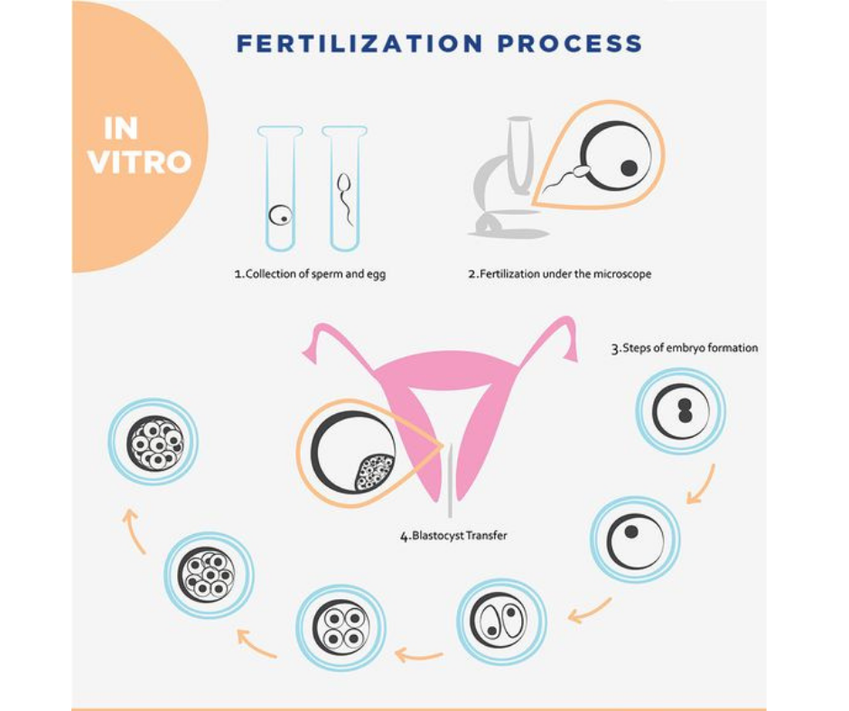 In Vitro Fertilization Process... - IVF and Parenting Support | Facebook
