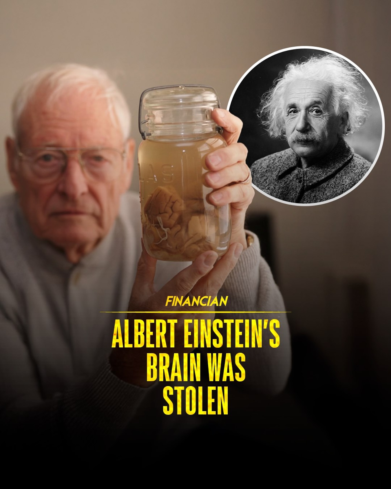 Financian When Albert Einstein Died In 1955 At Princeton Hospital 3339