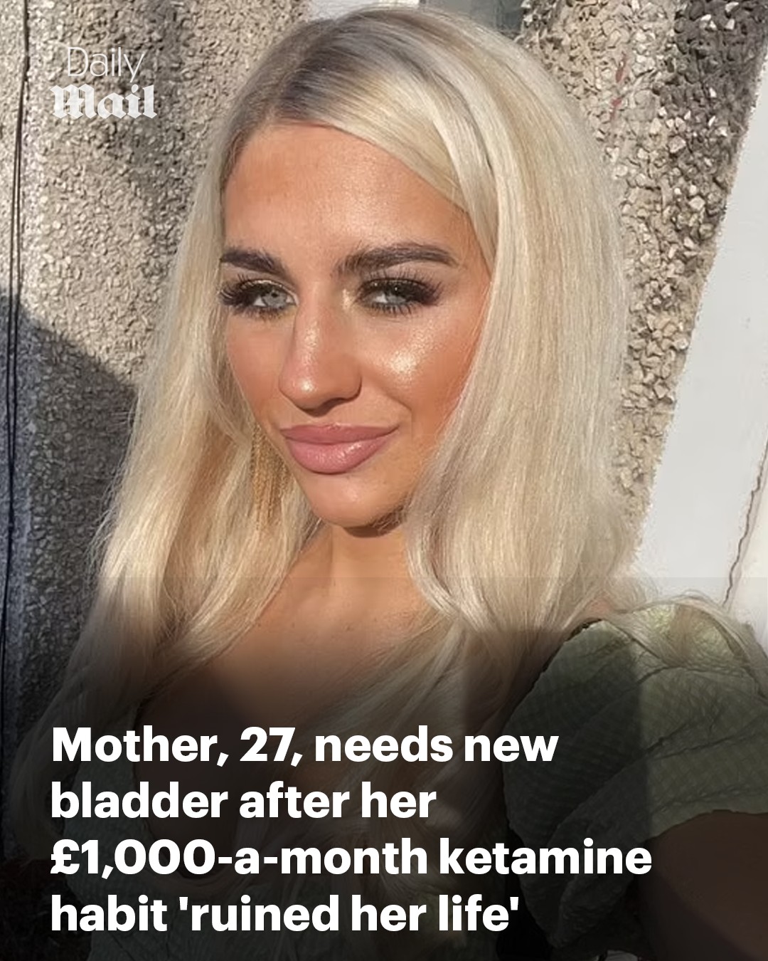 Daily She Has To Wear A Pad Every Day To Stop Her From Wetting