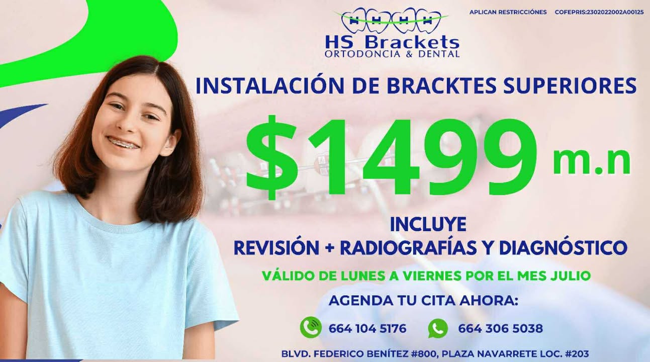 Hs Brackets Programa Happy Smiles Sistemas Metalicos 🦷brackets Sin 8371
