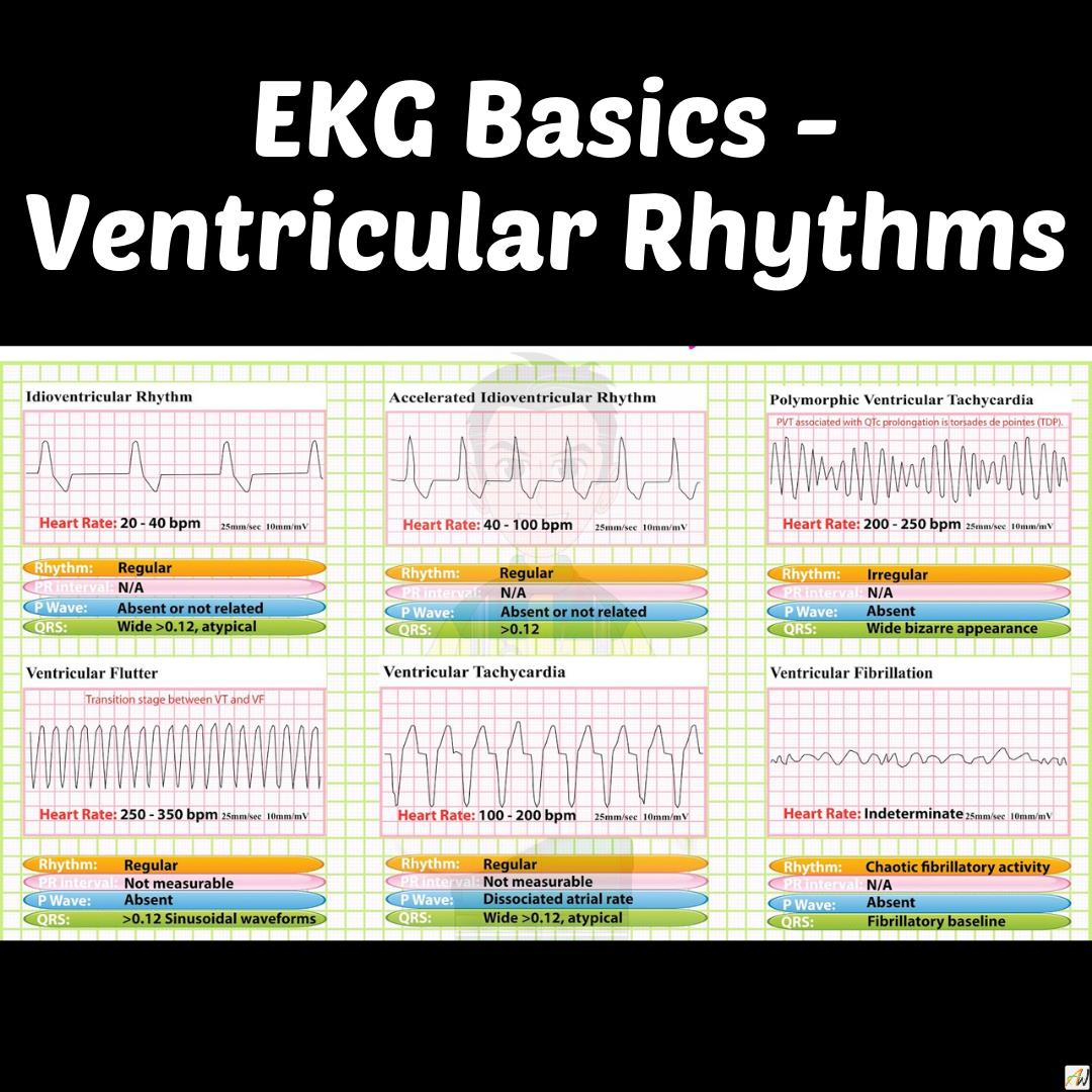 EKG Central - 🔰 EKG Basics - Ventricular Rhythms 🔰 Learn... | Facebook