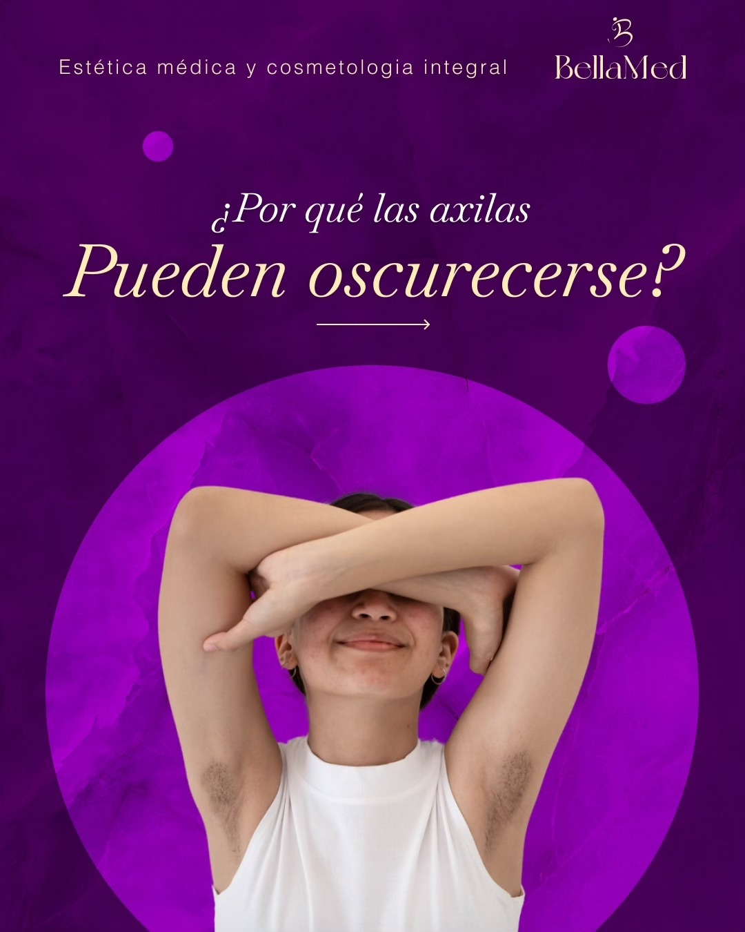 Bellamed Spa ¿sabías Que Las Axilas Oscuras Pueden Ser