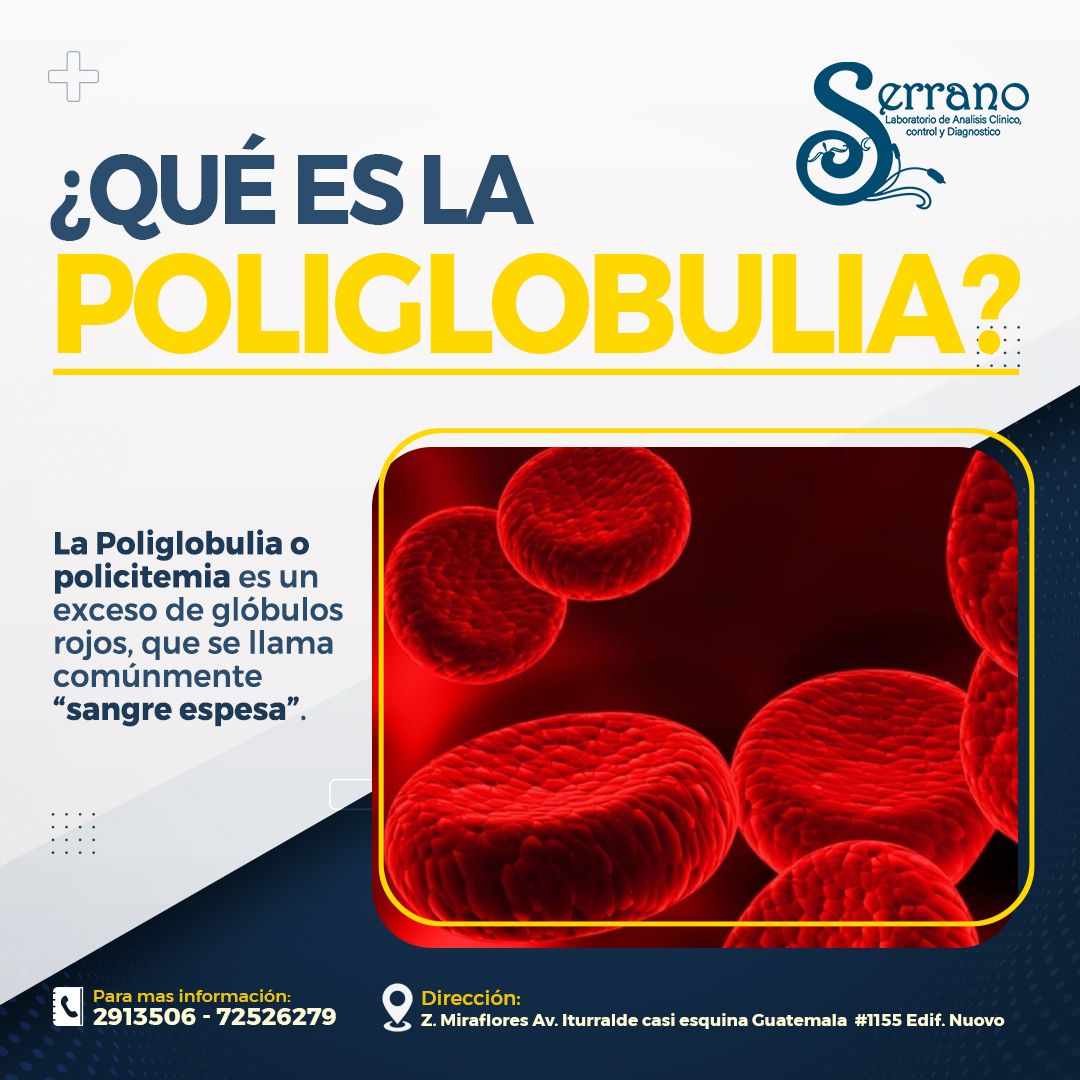 Laboratorio ¿𝐐𝐮é 𝐞𝐬 𝐥𝐚 𝐏𝐨𝐥𝐢𝐠𝐥𝐨𝐛𝐮𝐥𝐢𝐚 La Poliglobulia O Policitemia Es