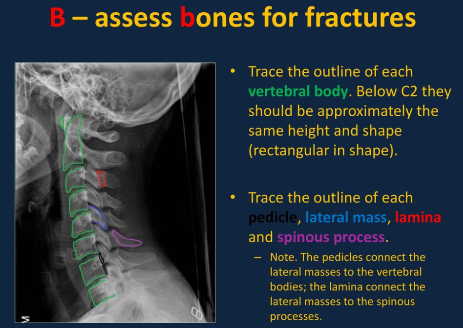 Medshare Film Lateral C Spine For Pediatrics And Adult Facebook 5952