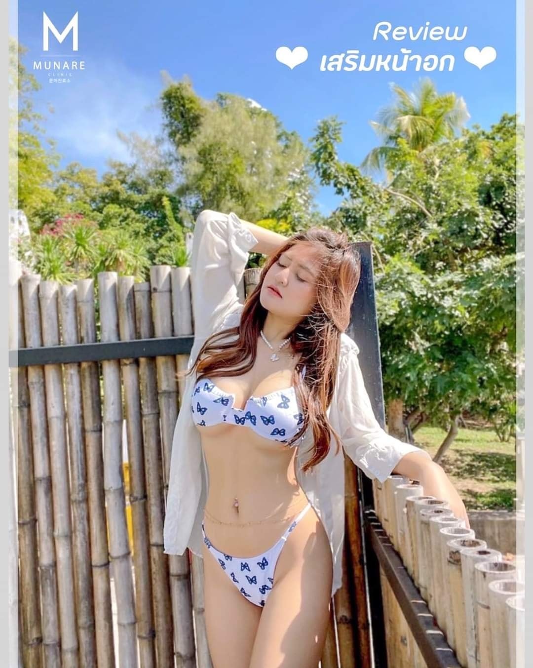 เพิ่ม Sex รีวิว มุนอา คลินิก ดูดไขมัน ศัลยกรรมเชียงใหม่
