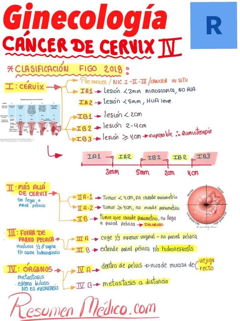 Resumen Clasificación De Cáncer De Cervix Figo 2018