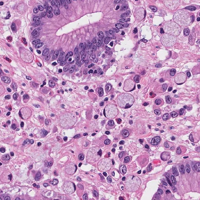 Ottawa Atlas Of Pathology Ottawa Atlas Of Pathology
