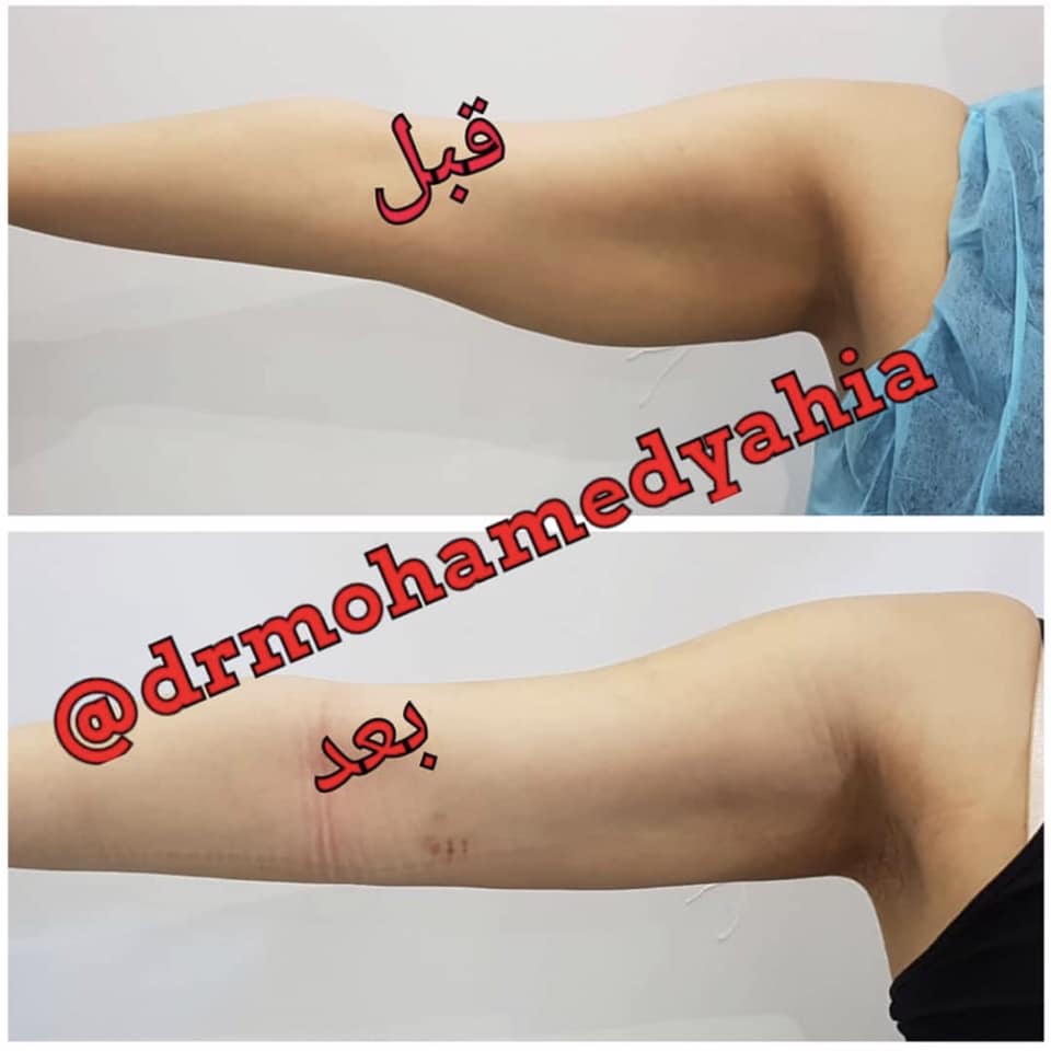 Cosmetic Surgery Clinic Kuwait Home Facebook