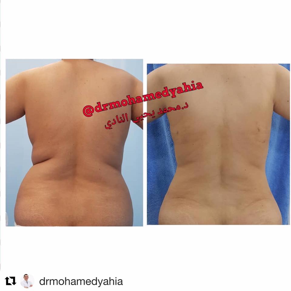 Cosmetic Surgery Clinic Kuwait Home Facebook