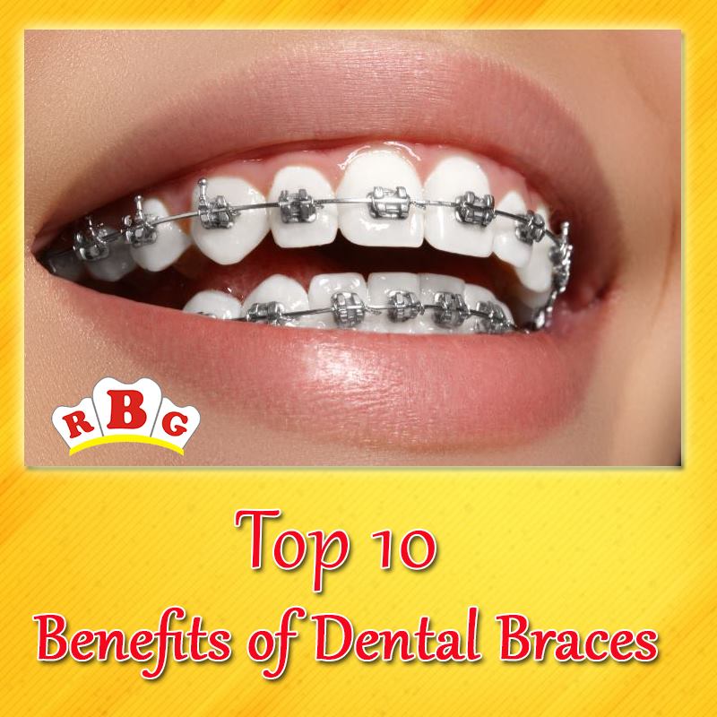 Unhealthy Gums With Braces