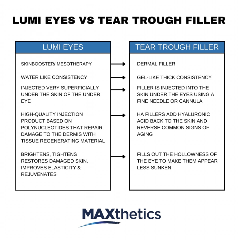 💙 Lumi Eyes Vs Tear Trough Filler 💙 Maxthetics Supplies 5879