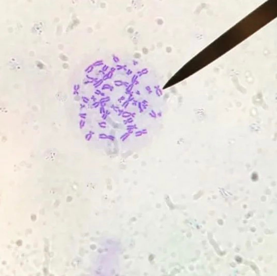 Vitagen X Chromosomes Inside A Cell Nucleus Shown Under A Microscope 6544