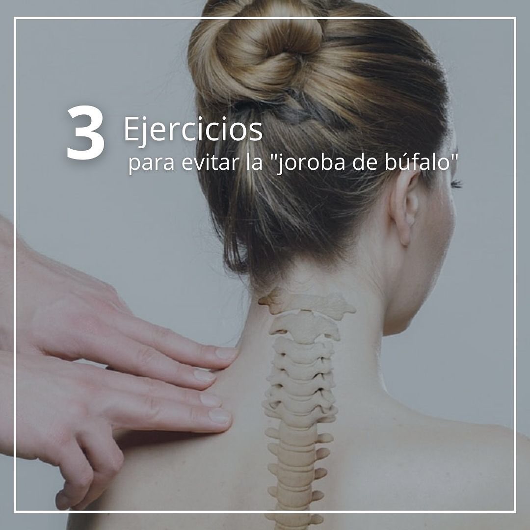 La Joroba De Búfalo Es Una Unidad Integral De Columna