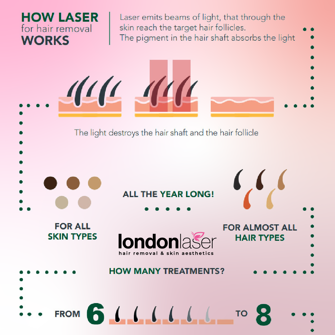How Laser For Hair Removal London Laser And Aethetics