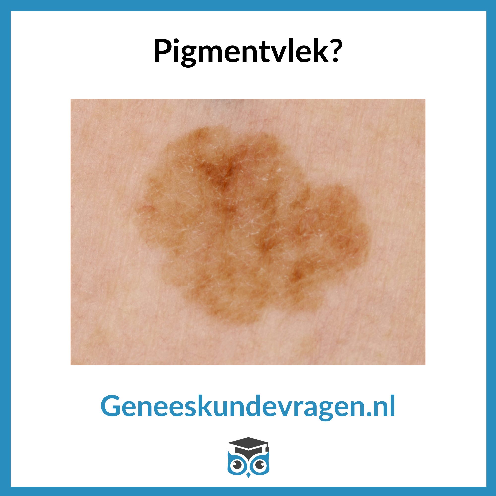 🦉 Een 72 Jarige Vrouw Maakt Zich Geneeskundevragen Nl