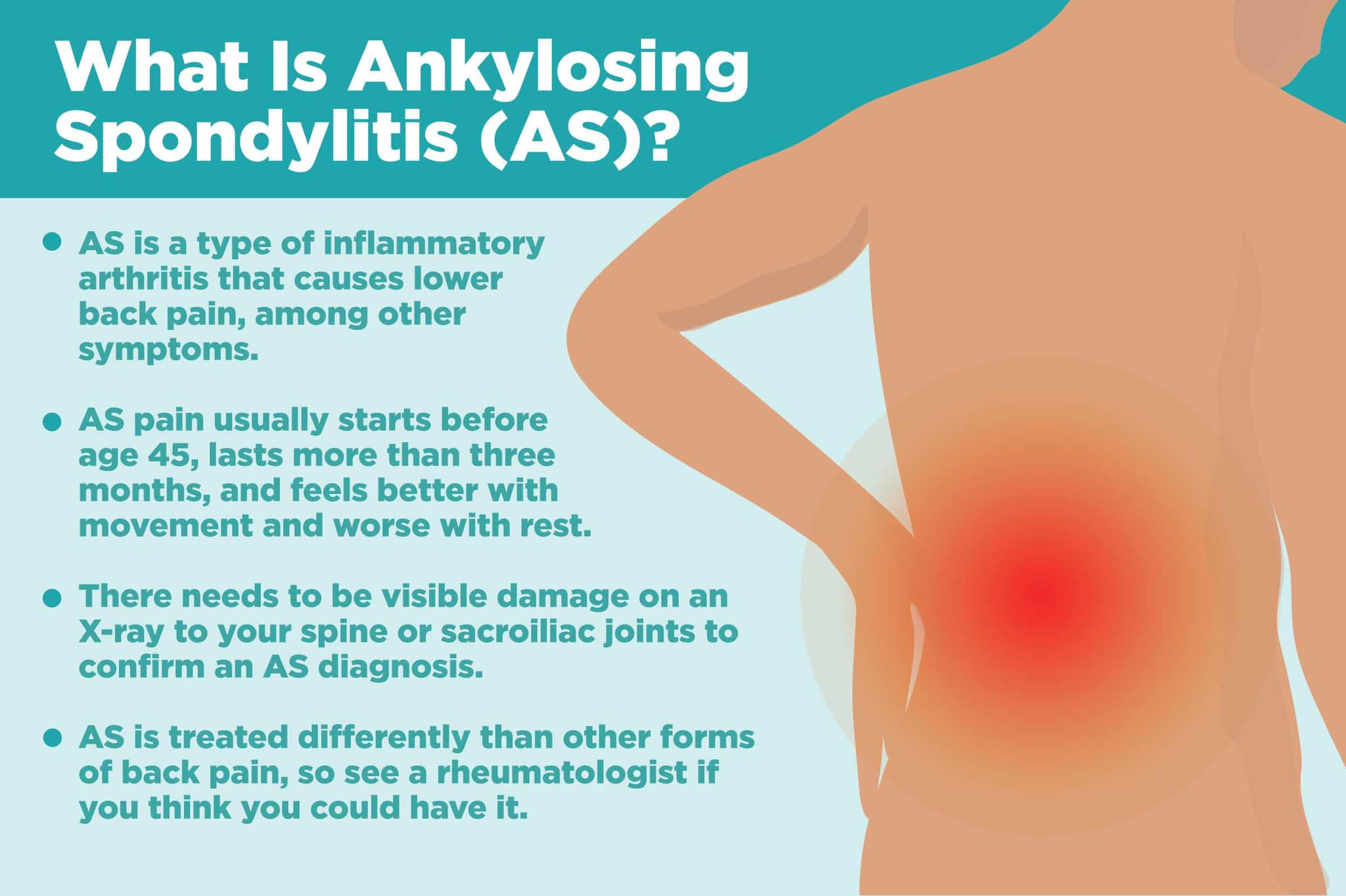 The Ankylosing Spondylitis Project
