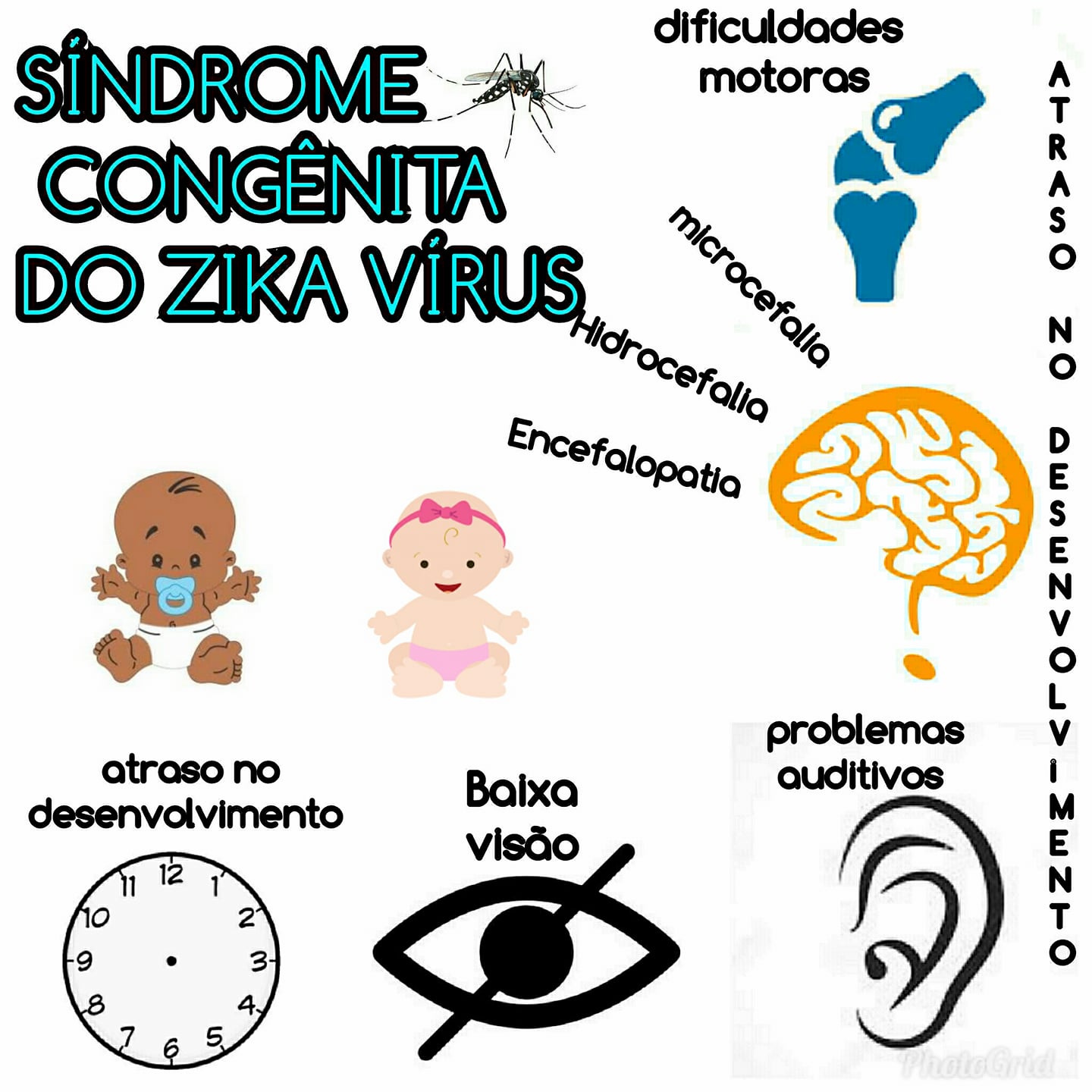 Síndrome Congênita Do Zika Vírus