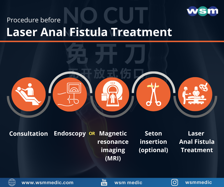 Wsm Medic What Need To Be Done Before Laser Anal Fistula