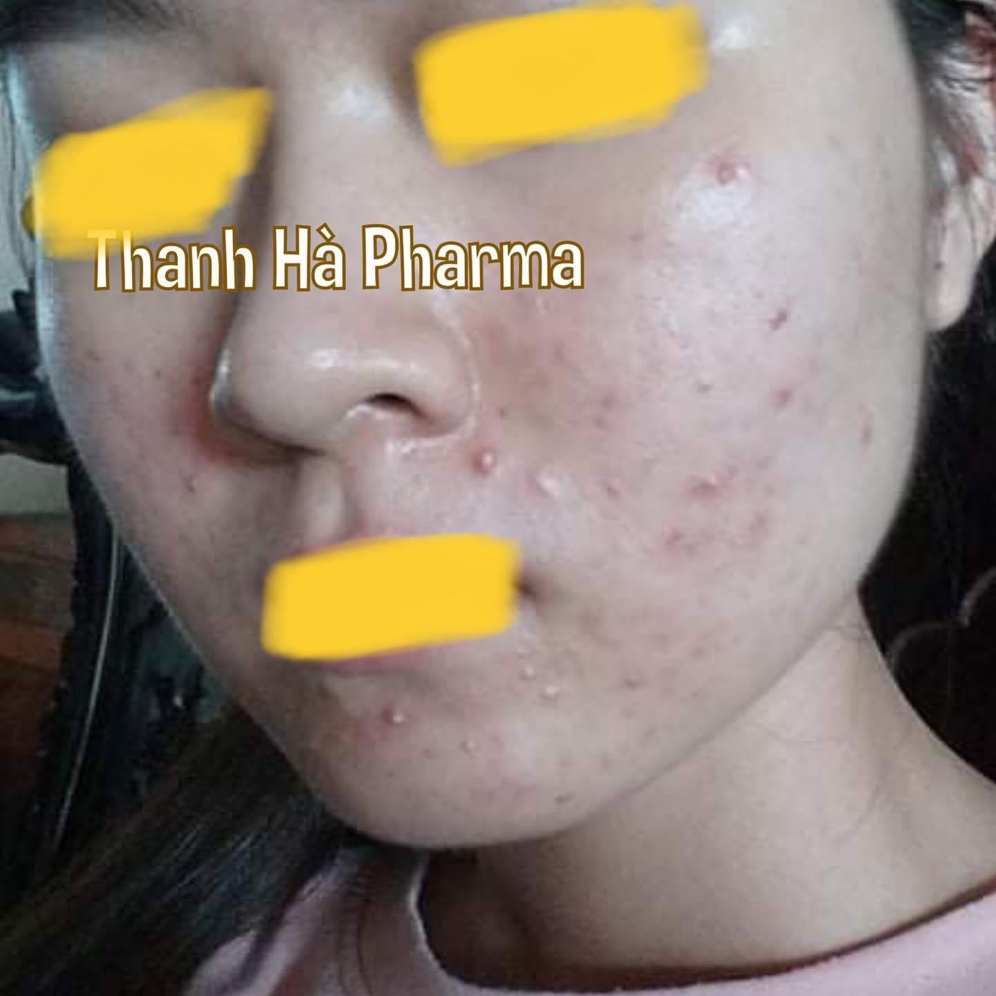 Dược Mỹ Phẩm Chính Hãng Hanoi 3385