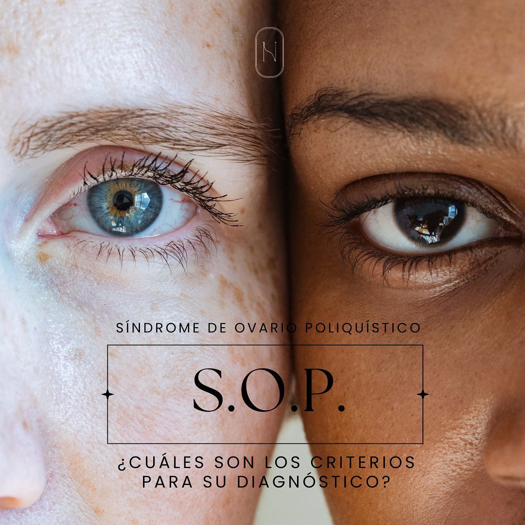 Nat Nutrición El Síndrome De Ovario Poliquístico Se 3542