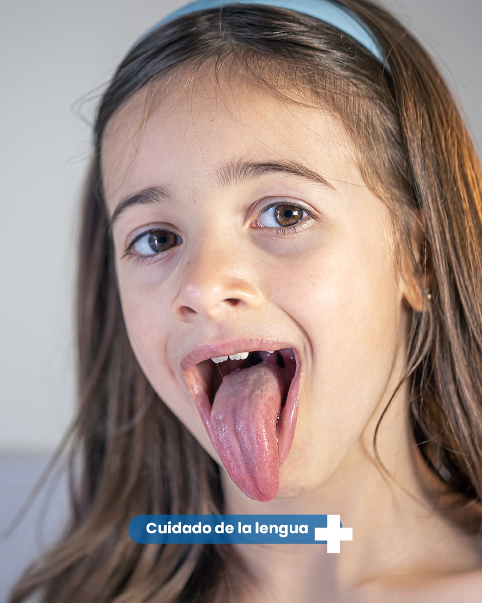 Dr 👅 Tu Lengua También Necesita Cuidados 🪥 La Acumulación De