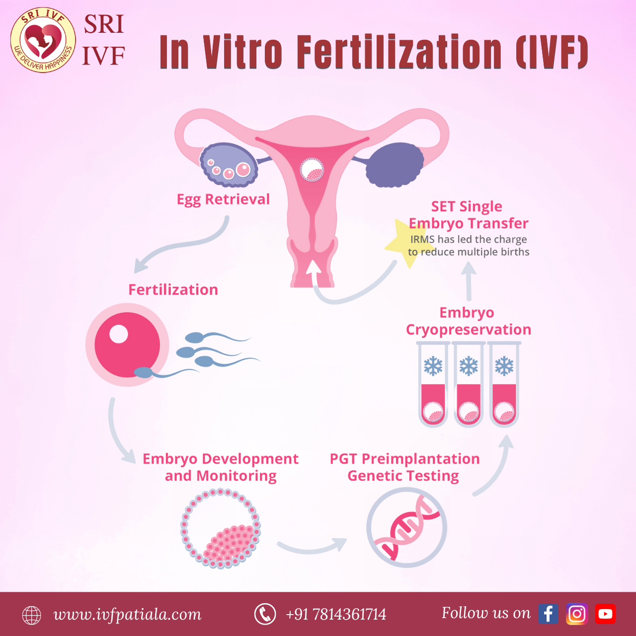 SRI IVF - In Vitro Fertilization (IVF): Process And...