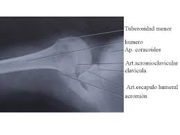 Mi Radiología Metodo De Lawrence Vuelo De Pájaro Facebook