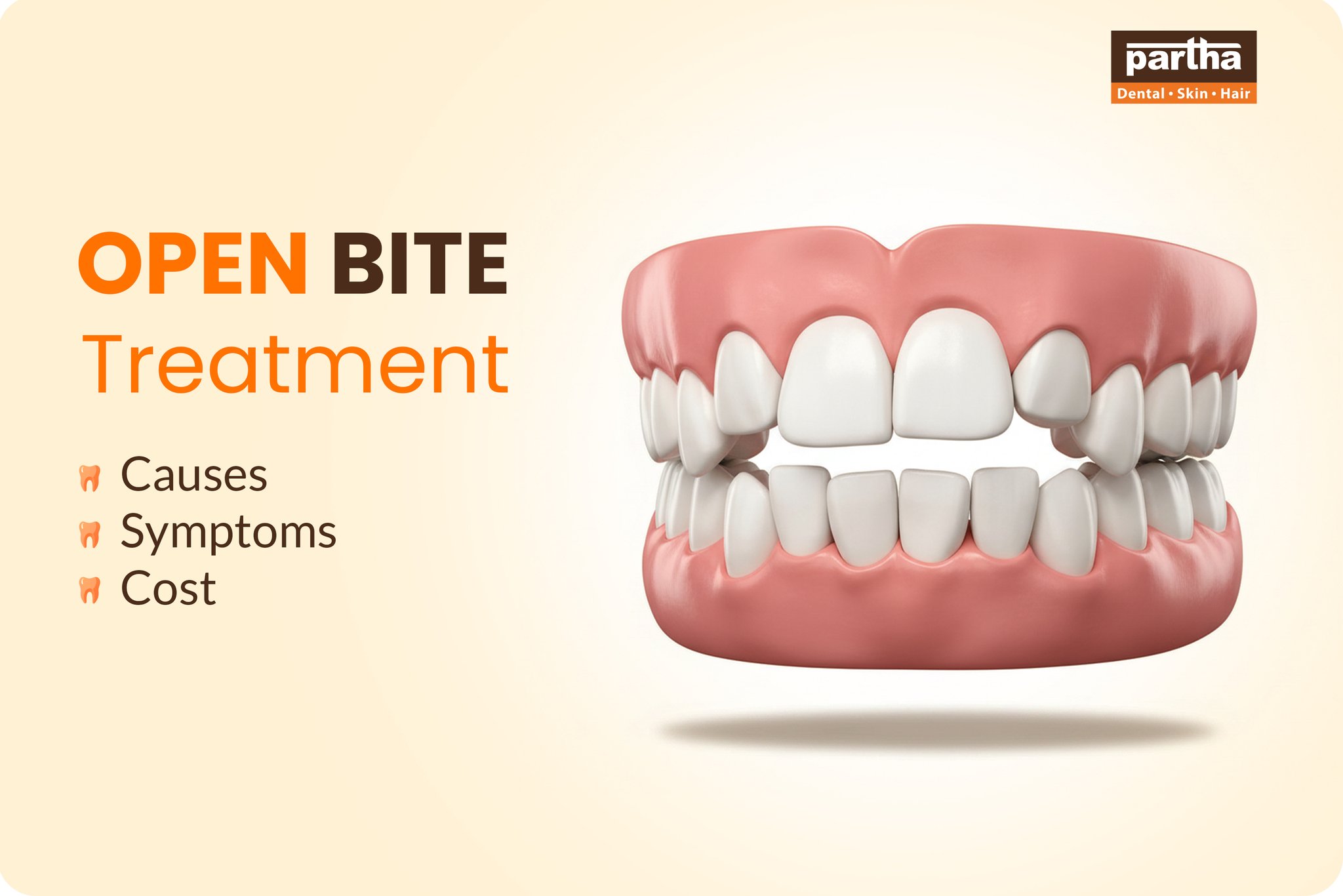 Thanisandra - If you’ve ever wondered what causes an open bite, how it ...