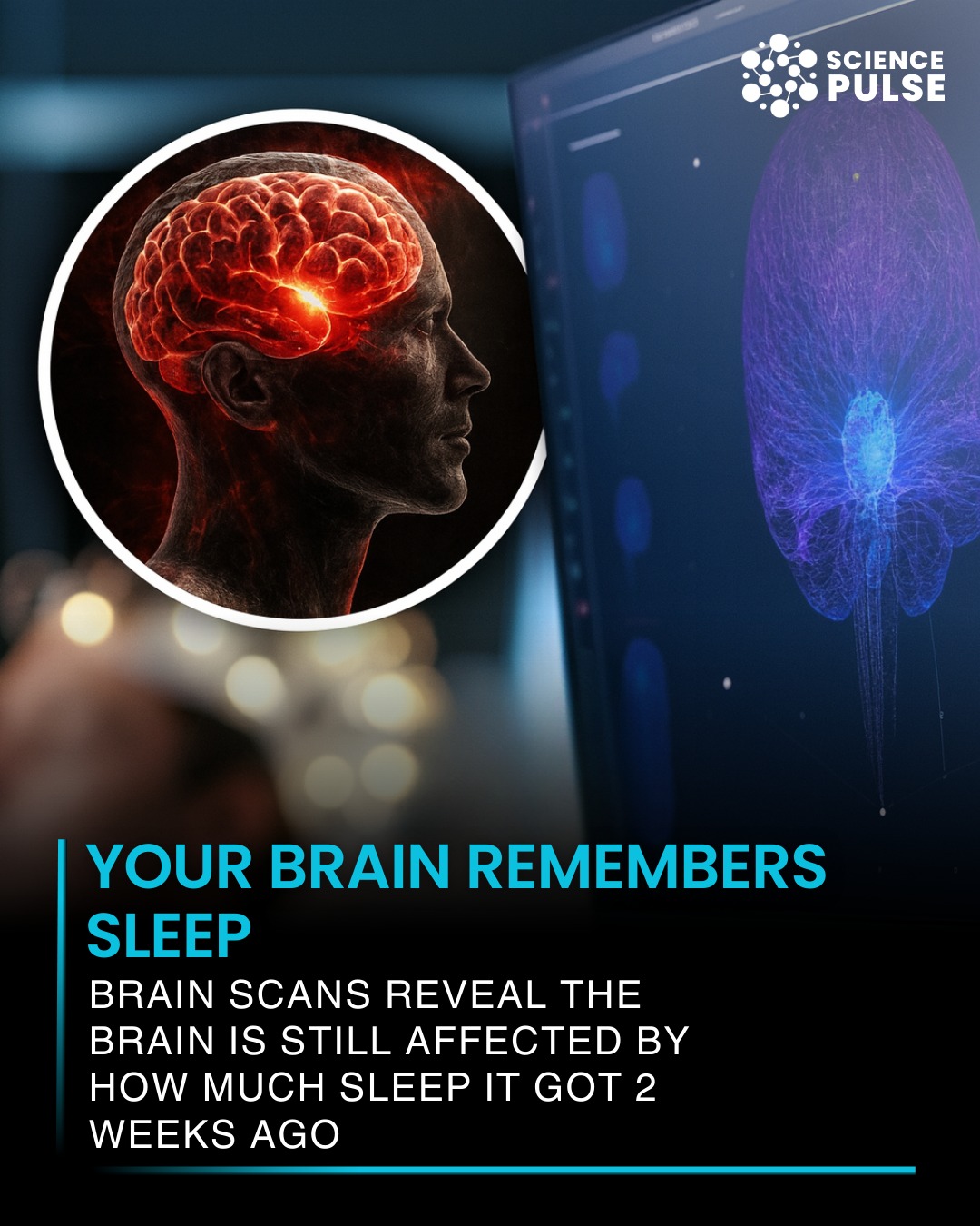 Science - A groundbreaking 133-day neuroimaging study has revealed just ...