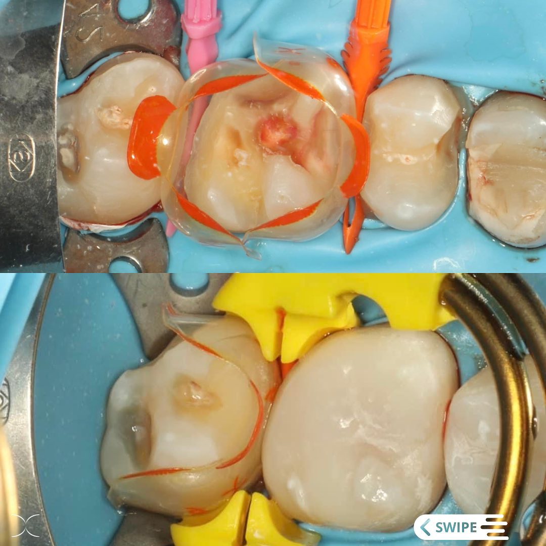The Evolve Matrix System In Bioclear Matrix System