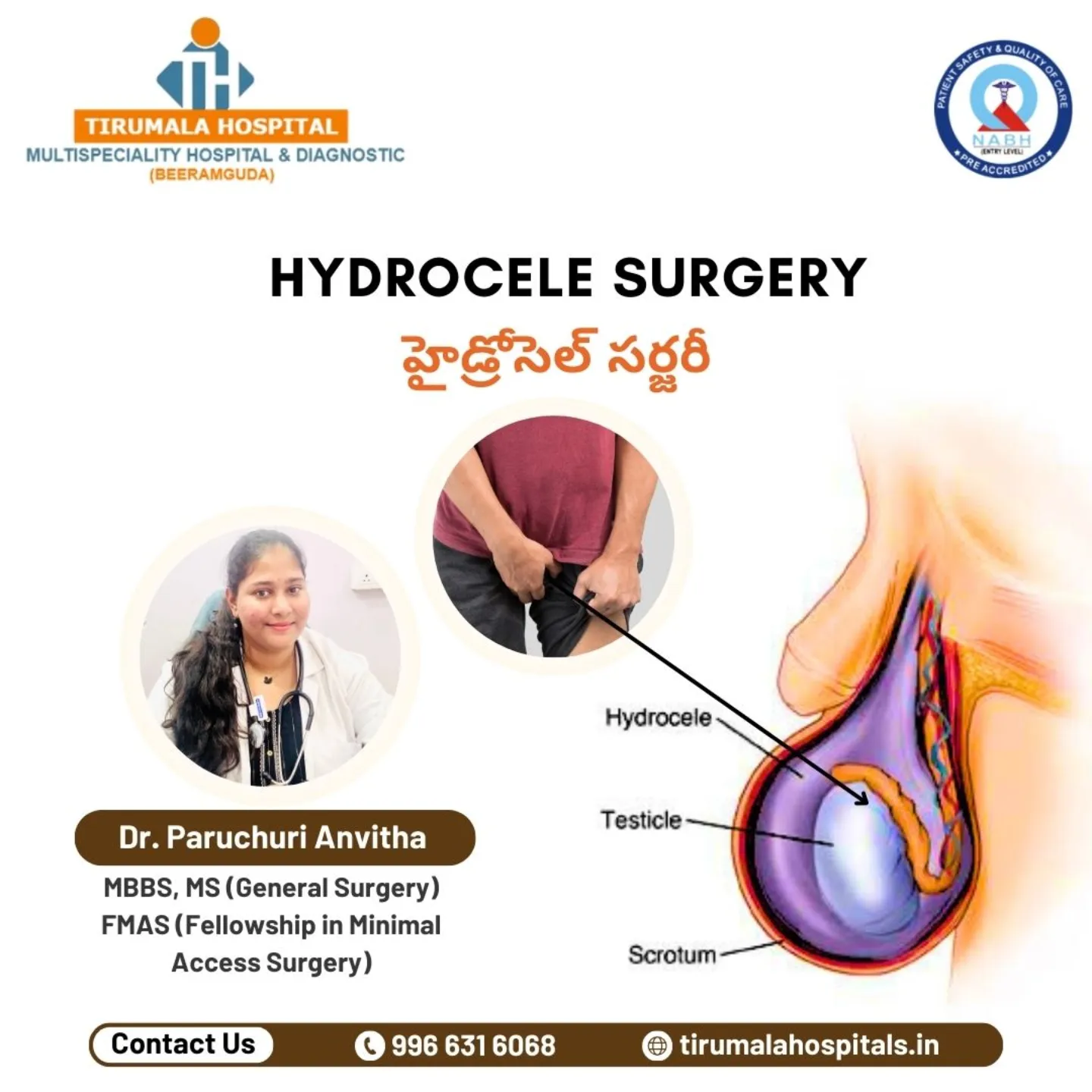 Tirumalahospital Hydrocele Surgery Hydrocelectomy A Hydrocele Is A